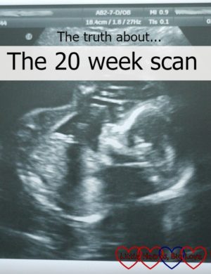 The truth about... the 20 week scan - Little Hearts, Big Love