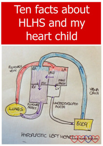 Ten facts about HLHS and my heart child - Little Hearts, Big Love